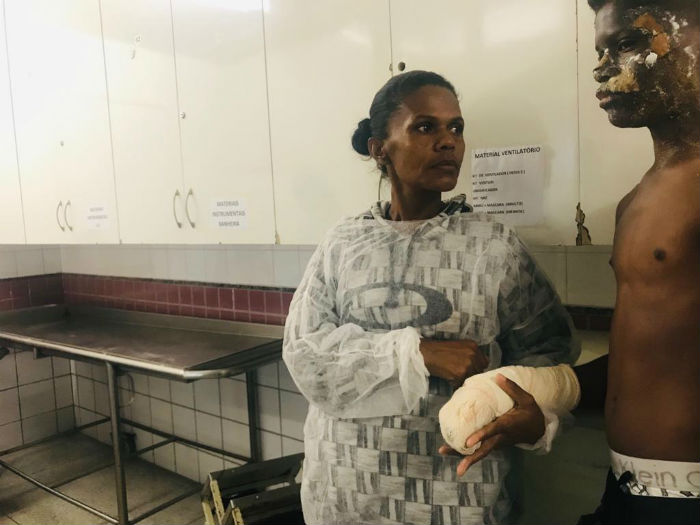 HR contabiliza 41 pessoas com queimaduras neste São João | Local ...