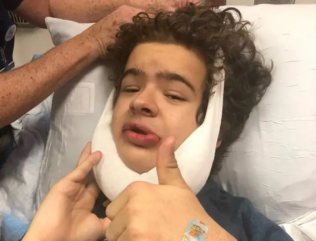 'Dustin', de 'Stranger Things' passa por cirurgia devido à doença ...
