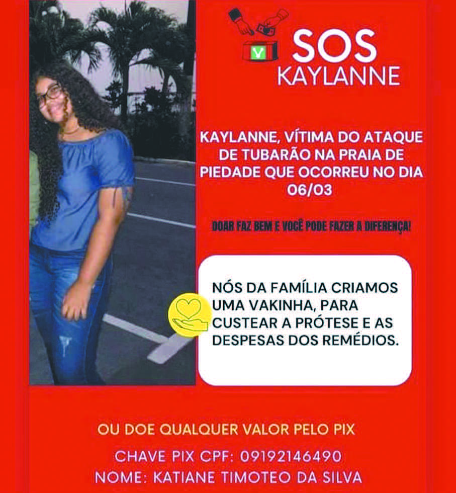 Vítima de tubarão, Kaylane pede ajuda em vaquinha virtual | Local: Diario de Pernambuco