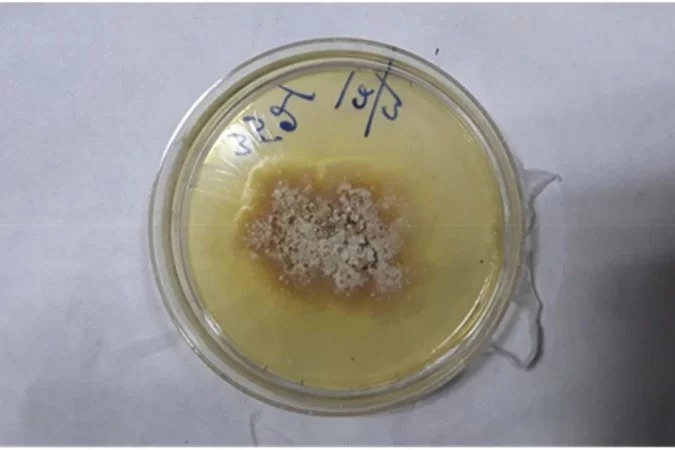 Fungo de planta assassina infecta ser humano pela primeira vez na ...